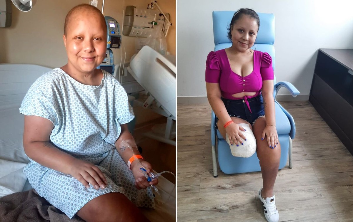 Morre jovem que lutava contra câncer e teve perna amputada: 'Amarei ...