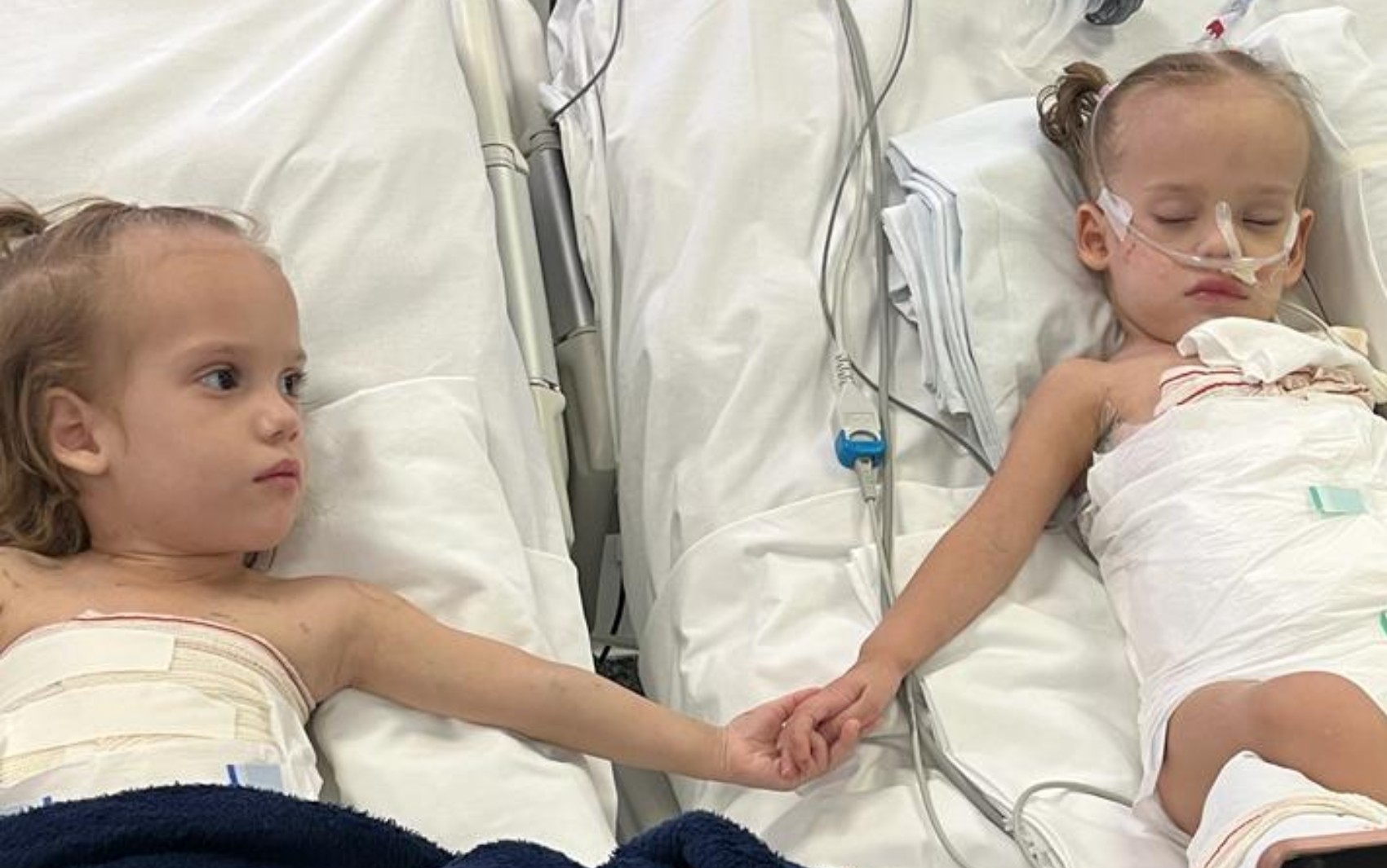 Tratamento com 200 profissionais e mais de 50 dias internadas: conheça ...