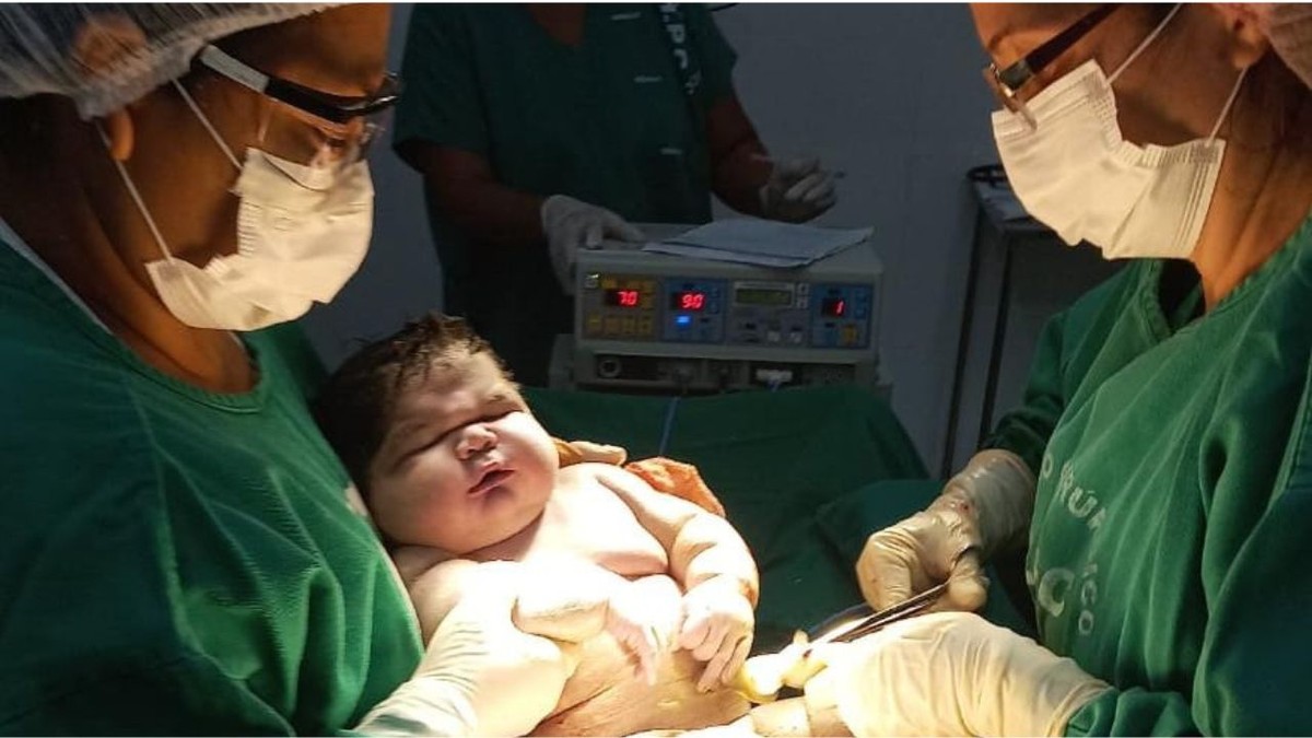 'Bebê gigante' que nasceu em Parintins com 7 kg quebra recorde é o ...