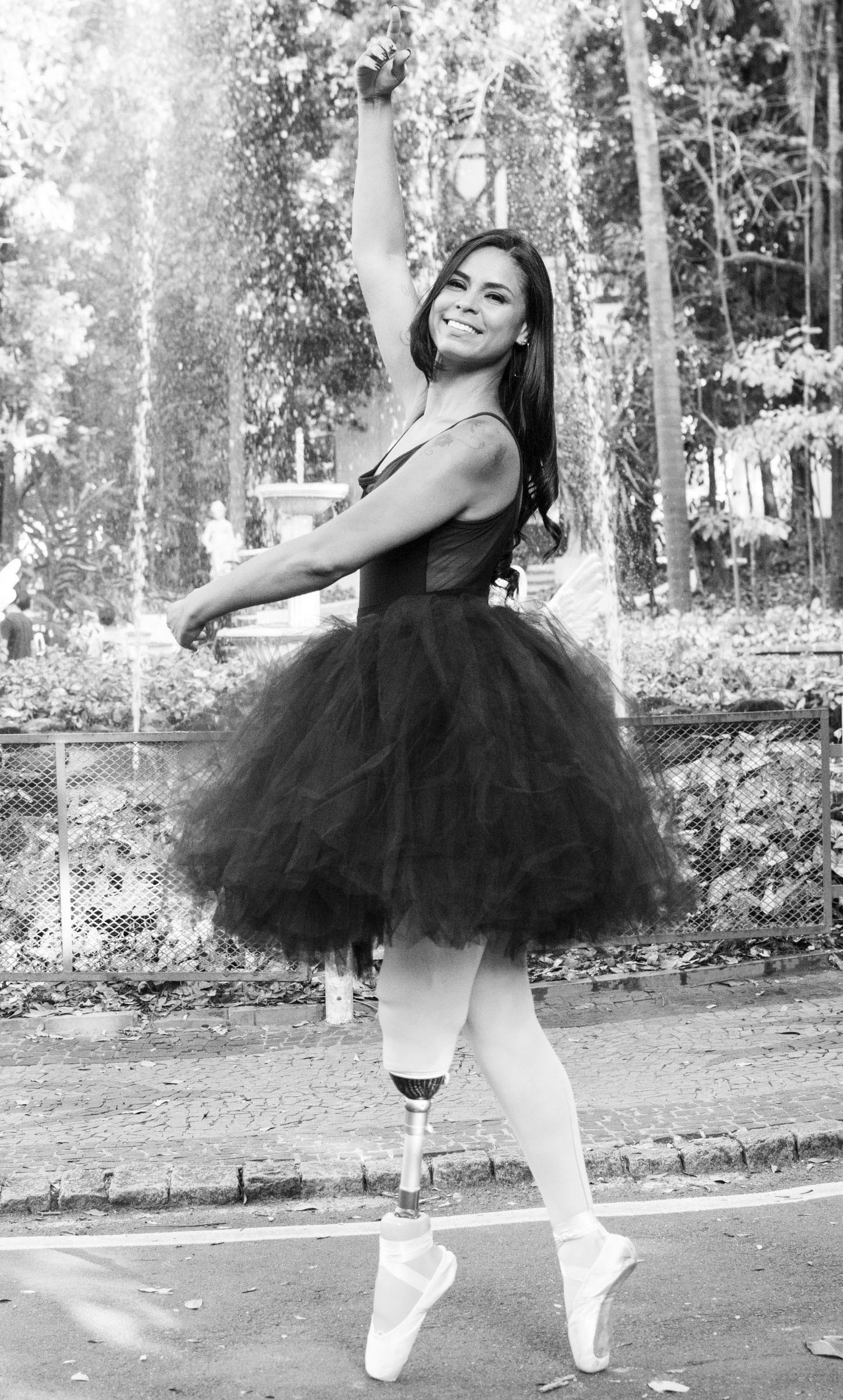 Ensaios valorizam força e beleza de mulheres amputadas: 'Quero que elas ...