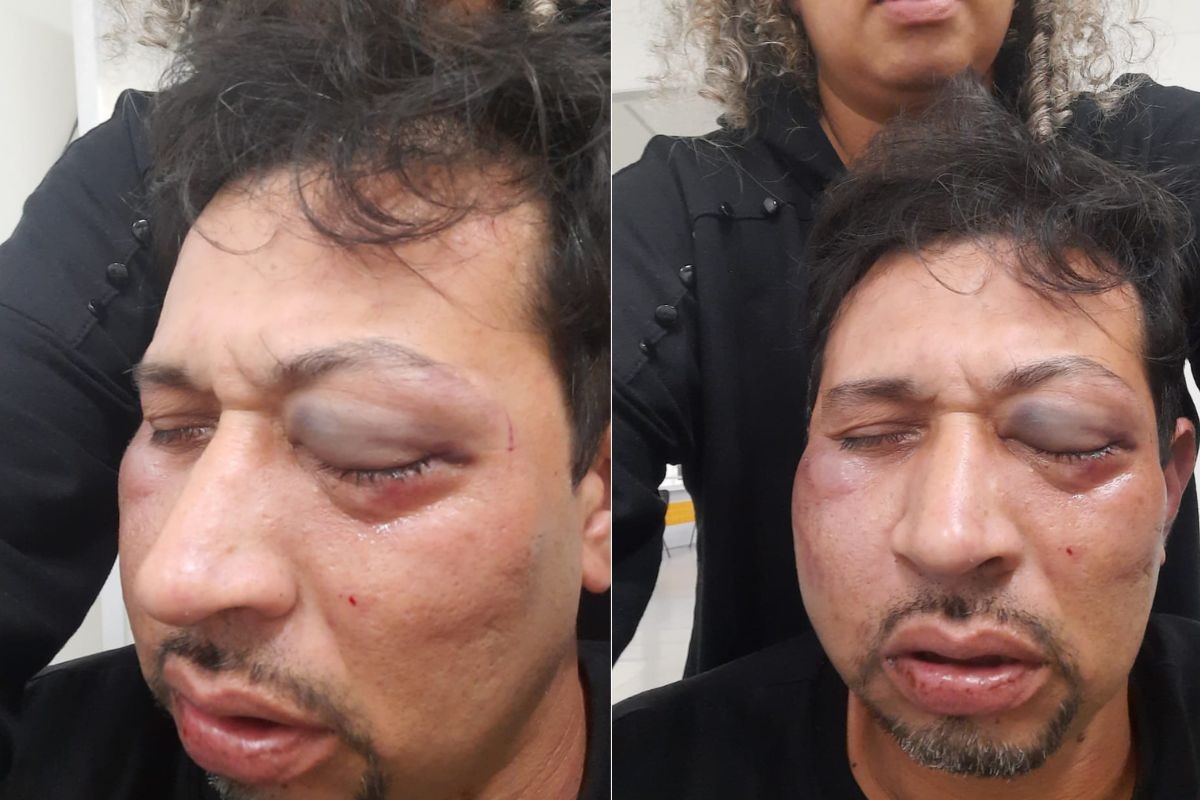 Autônomo é espancado por grupo em bar no litoral de SP: 'Só chorava ...