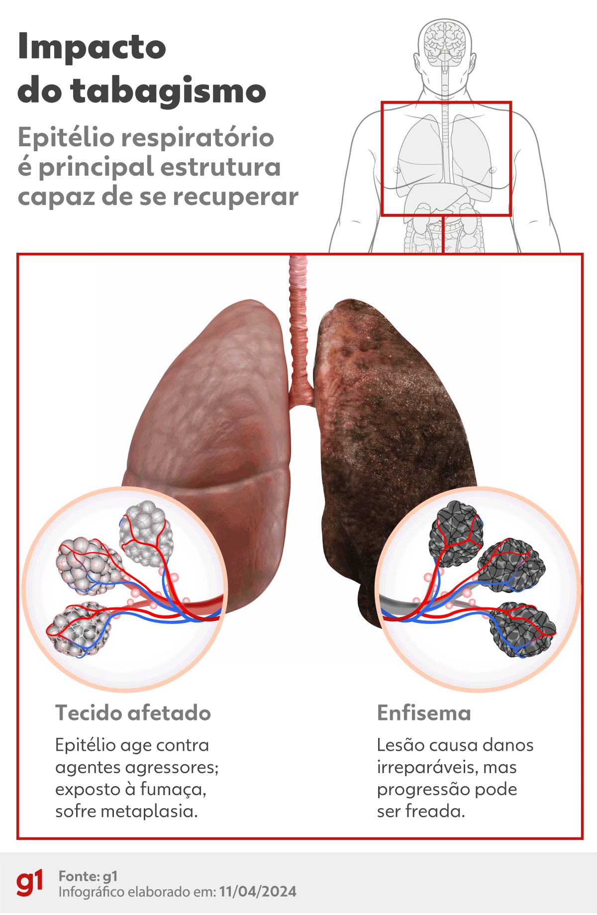 O que acontece com os pulmões quando você para de fumar? | Saúde | G1