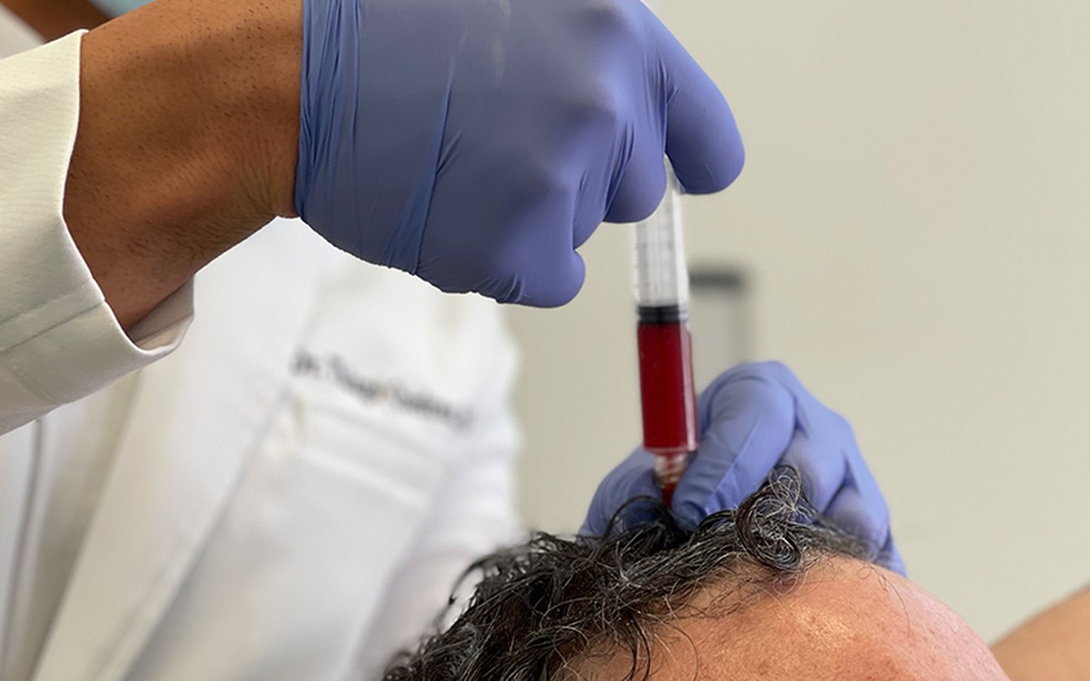 A quebra de tabus com relação aos problemas capilares | Estética ...