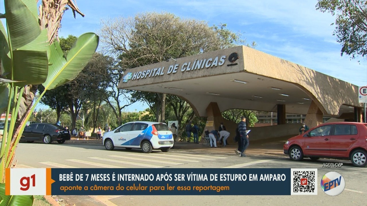 Bebê é internado em estado grave com fraturas no crânio, e padrasto é ...