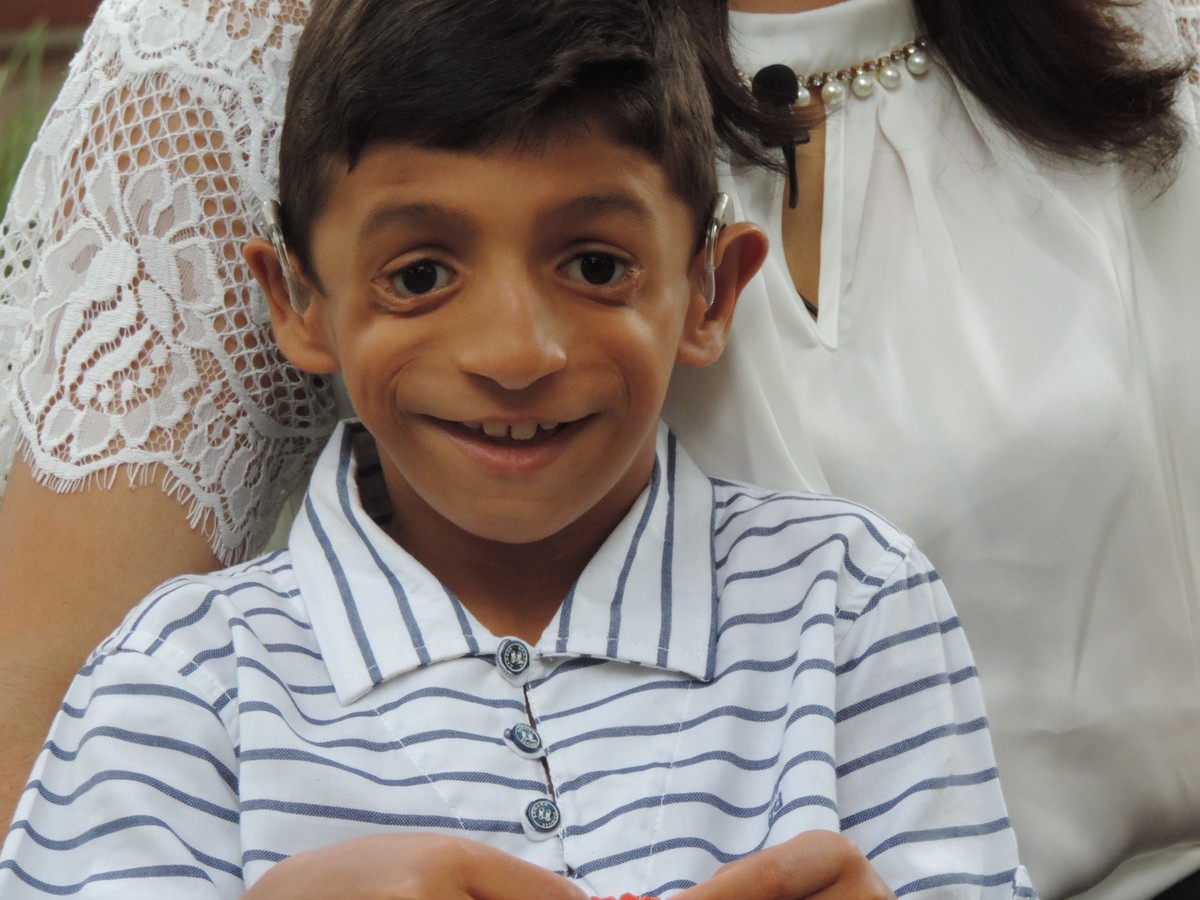 'Extraordinário': menino com síndrome retratada no filme já passou por ...