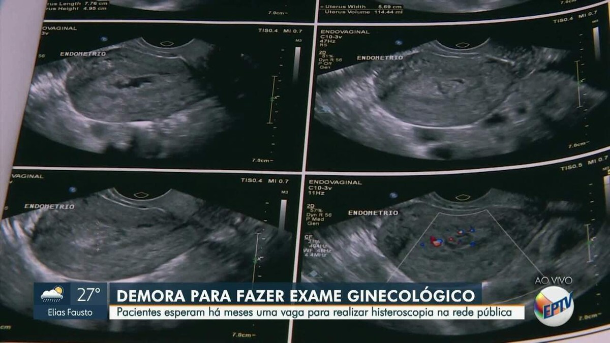 Com crises de dor, moradora de Campinas espera há três meses por exame ...