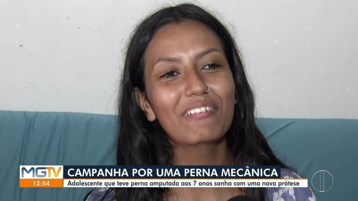 Adolescente que teve perna amputada aos 7 anos faz campanha para ...