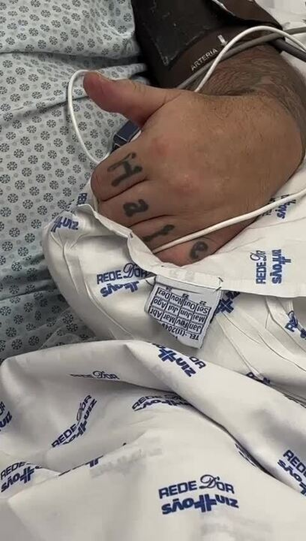 Seis meses após tiro na cabeça, Mingau, baixista do Ultraje a Rigor ...