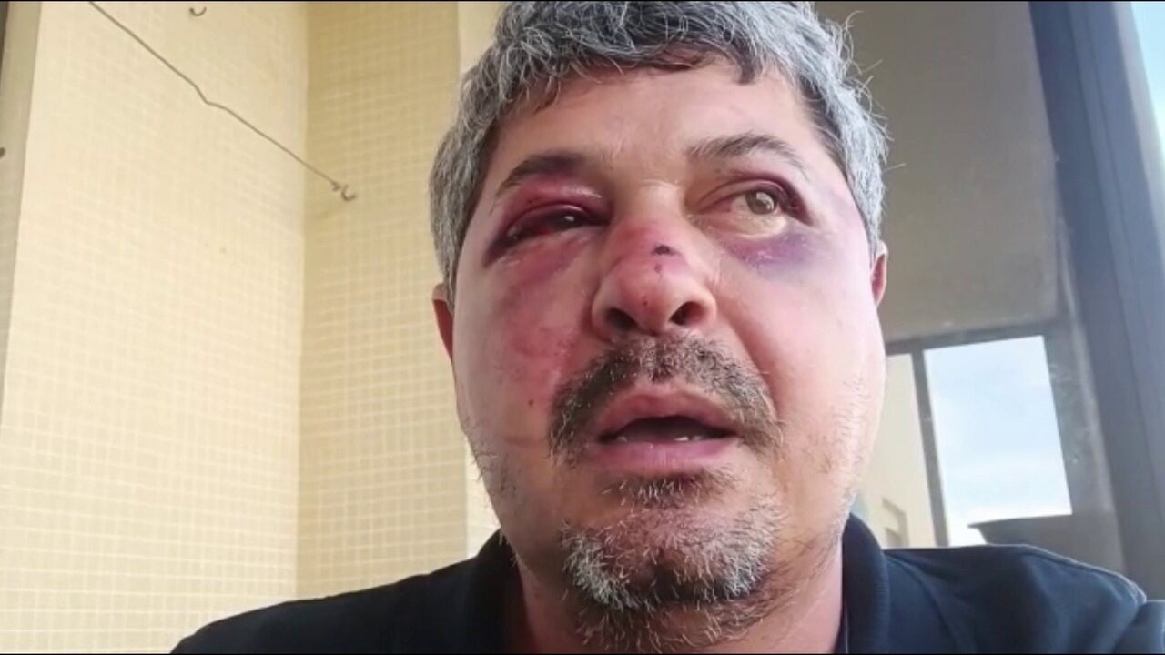 Brasileiro é espancado durante ataque xenofóbico em Portugal: 'chutou ...