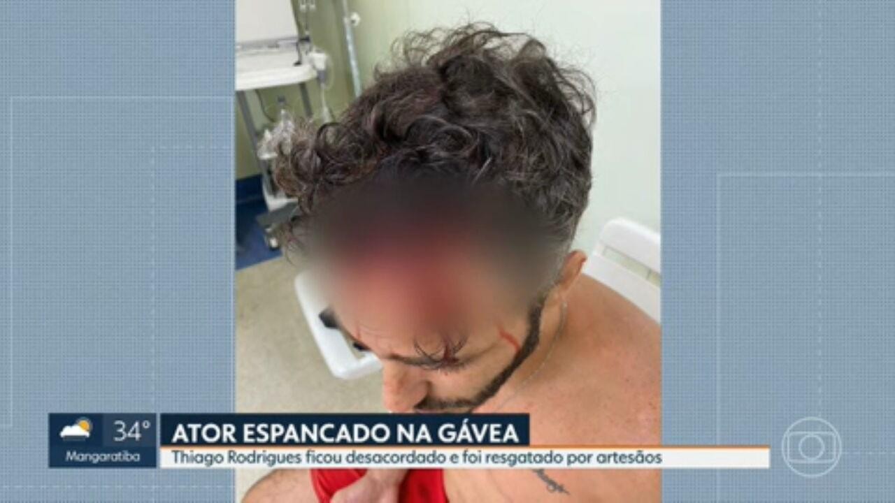 Imagem mostra ator Thiago Rodrigues ferido após assalto na Gávea | Rio ...