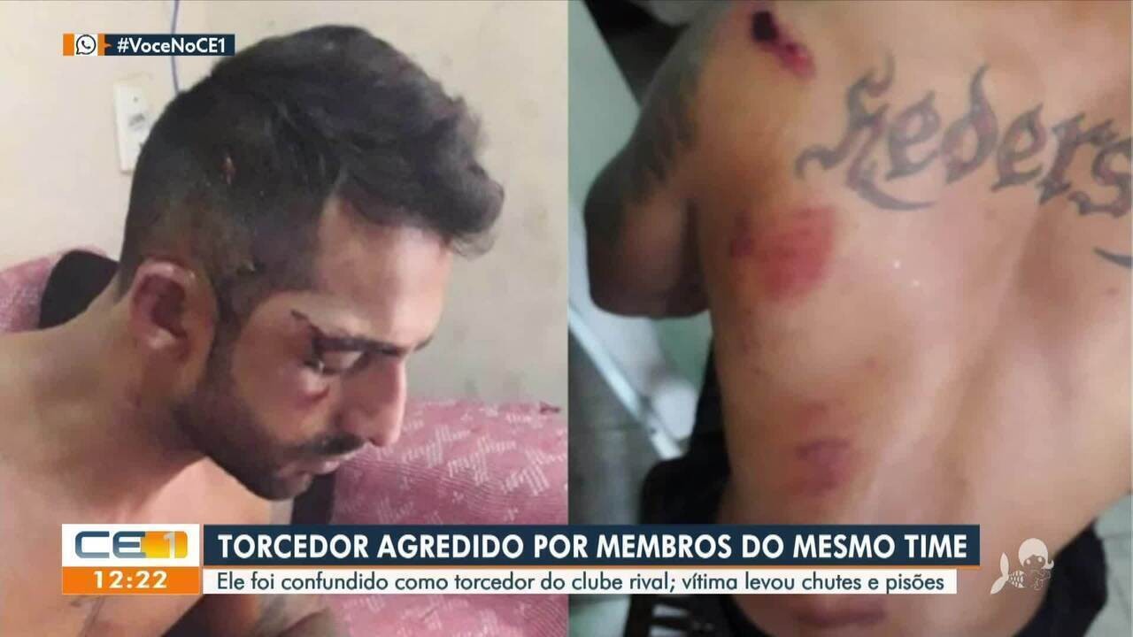 'Pensei que fossem meus últimos minutos', diz torcedor brutalmente espancado em Fortaleza ...