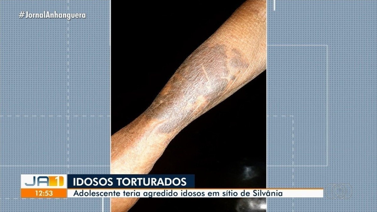 Adolescente é Apreendido Suspeito De Torturar Roubar E Manter Idosos