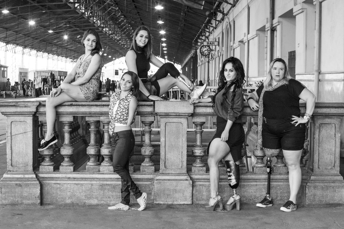 Ensaios valorizam força e beleza de mulheres amputadas: 'Quero que elas ...