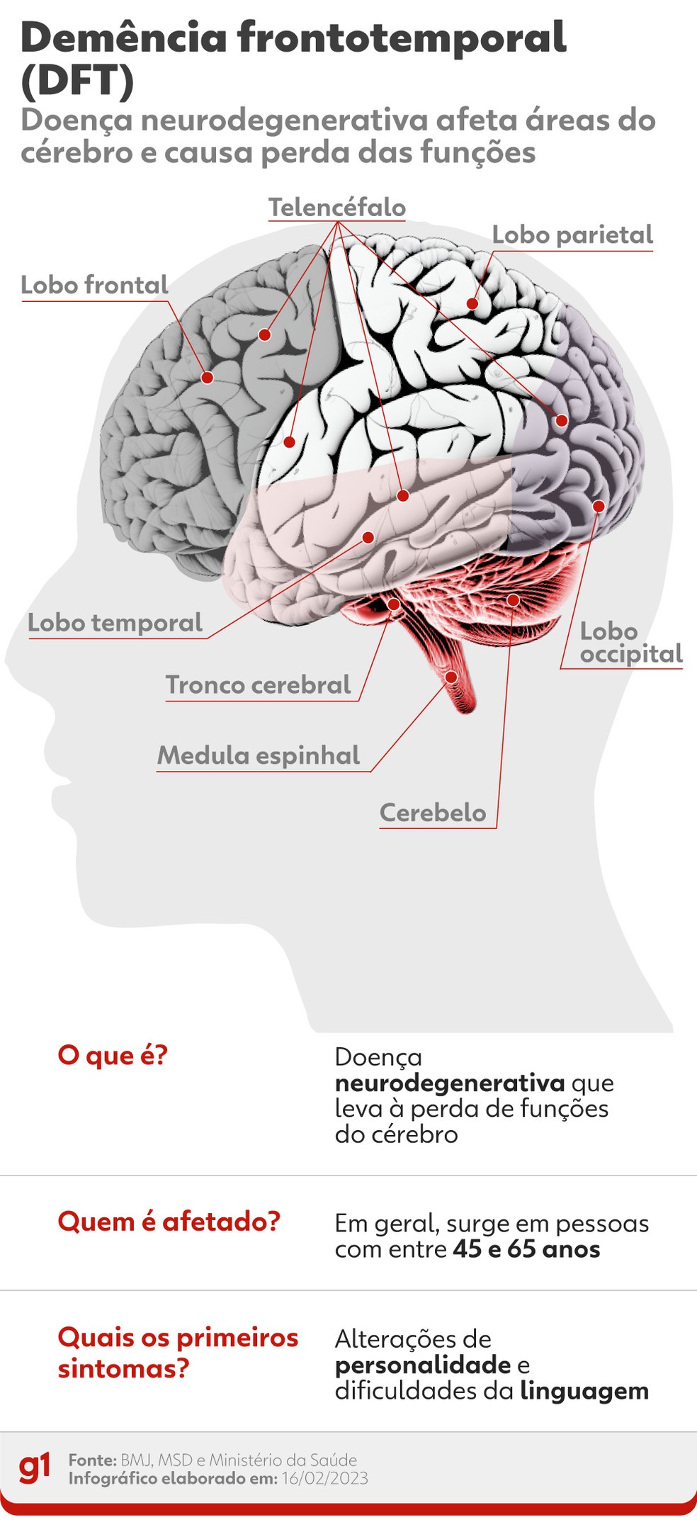 Demência frontotemporal: entenda doença que afeta Maurício Kubrusly ...
