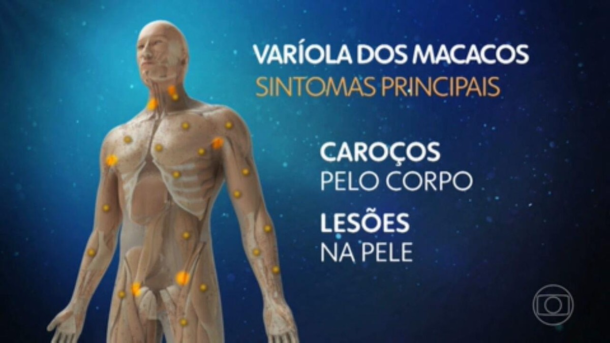 Varíola dos macacos: especialistas explicam os riscos e os cuidados ...