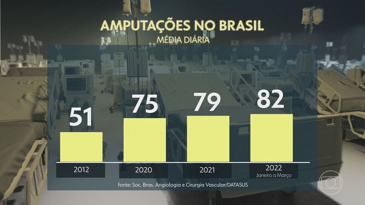 Médicos alertam para aumento de amputações no Brasil; média é de 82 ...