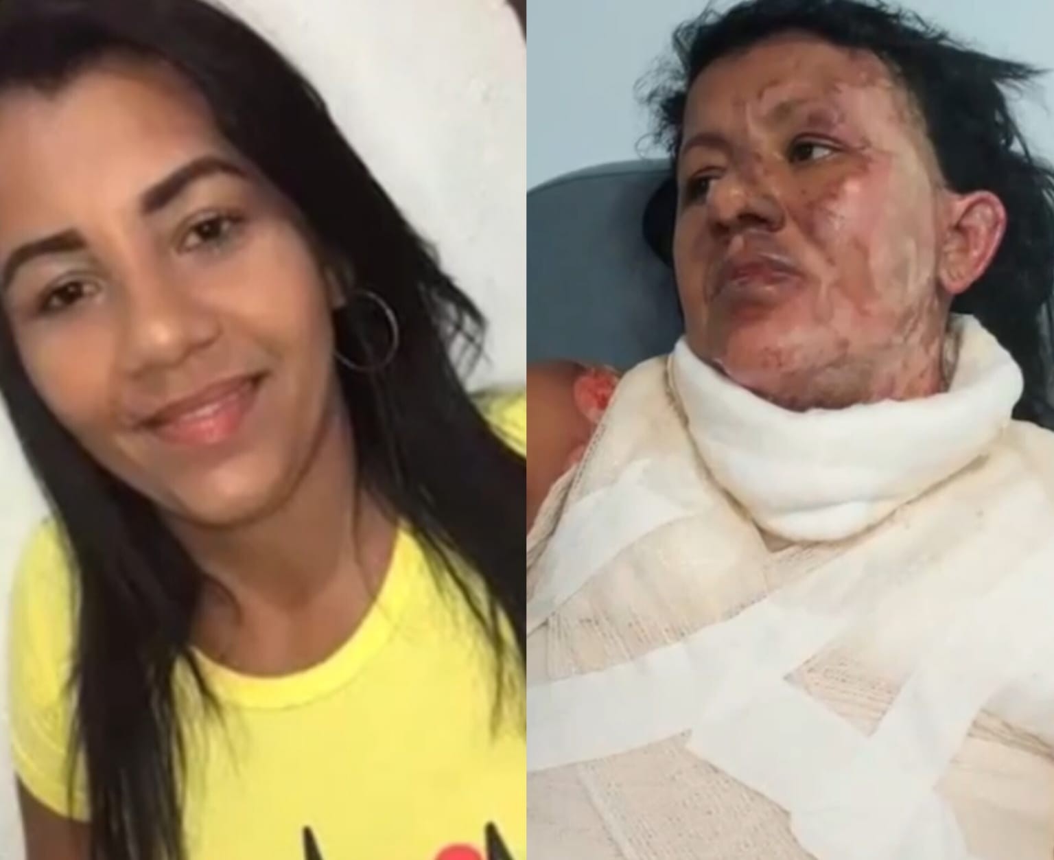Polícia prende suspeito de atear fogo na esposa no Antares, em Maceió ...