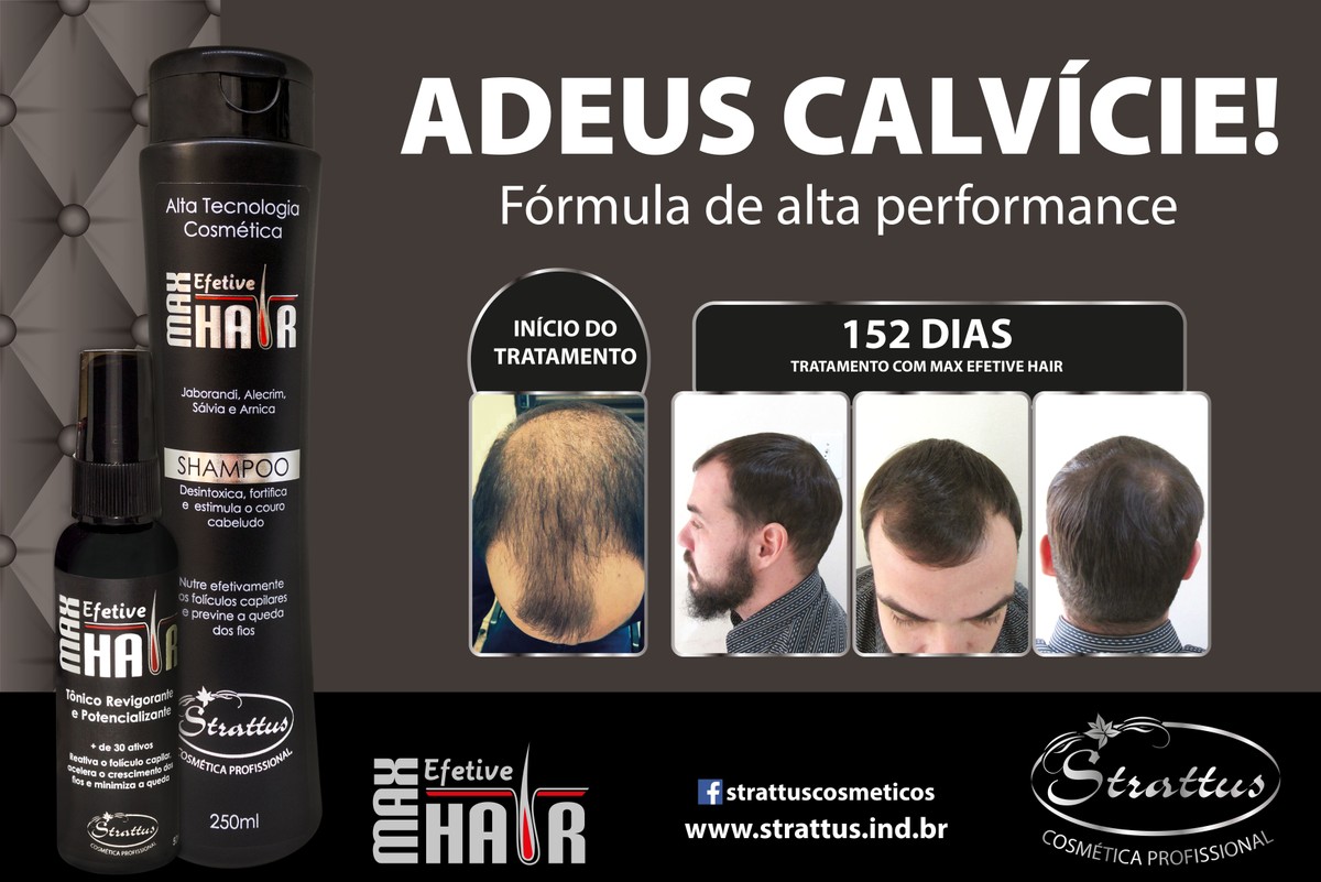 Dê adeus à calvície! | Especial Publicitário Strattus | G1