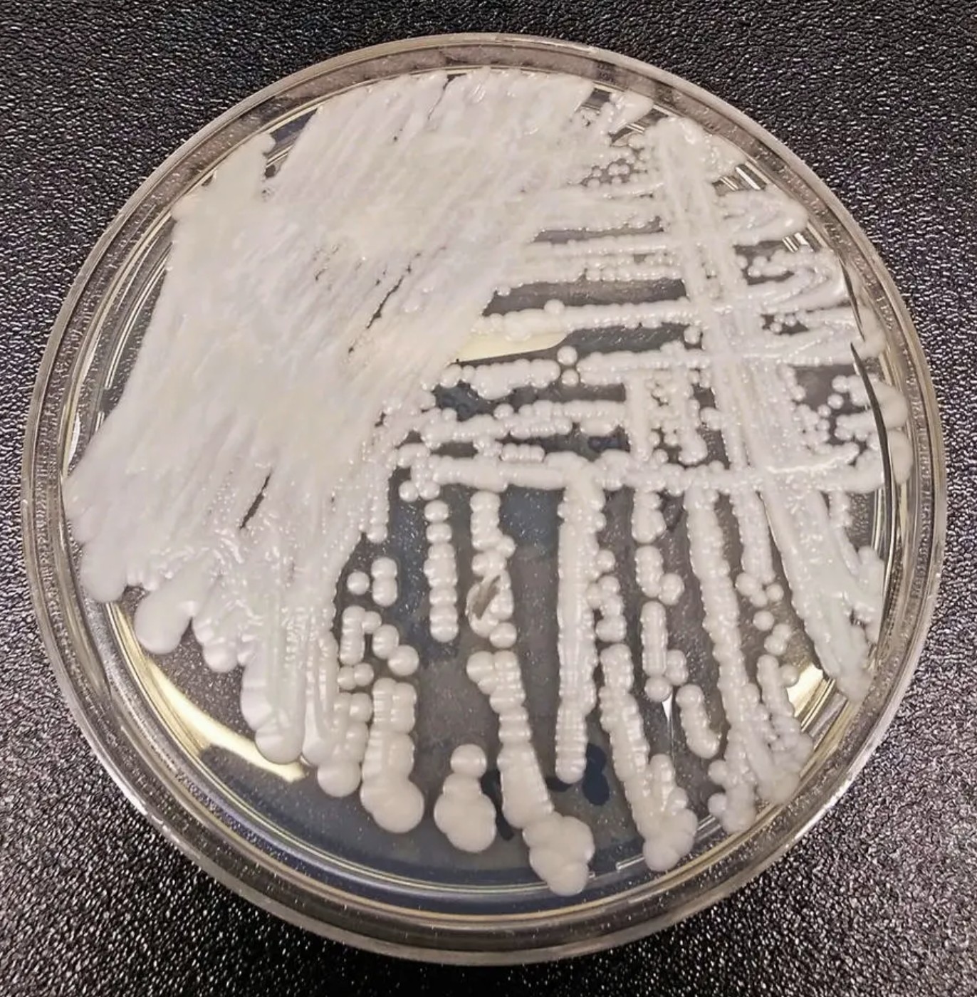 'Superfungo' em PE: o que é Candida auris e por que apresenta risco em ...