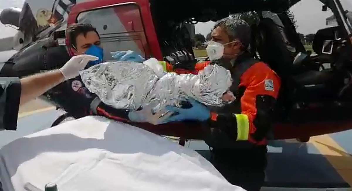 Bebê de 1 ano e 2 meses sofre queimaduras de 2º grau causadas por água ...