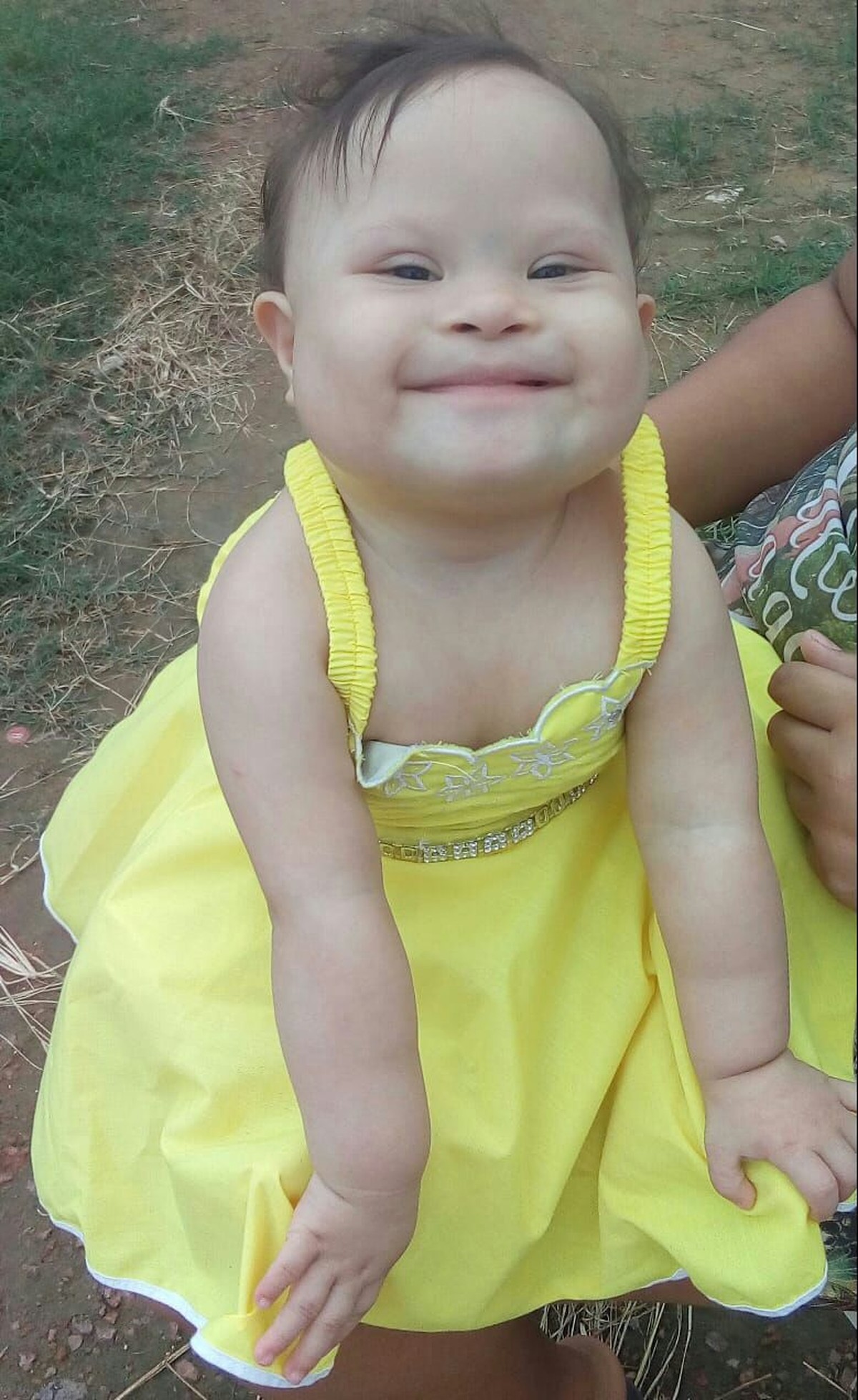 Família faz campanha e pede ajuda por cirurgia em coração de bebê com ...