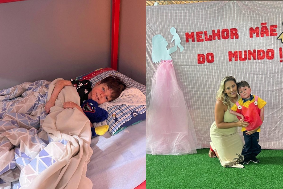 Lei Gui: Alerj aprova lei de assistência a pessoas com epidermólise ...