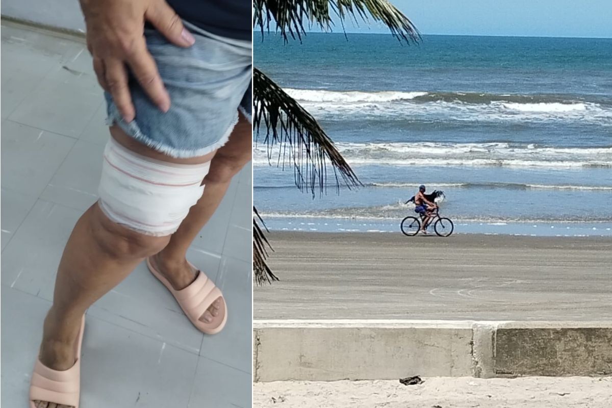 Cães sem coleira mordem nádega e perna de idosa em praia do litoral de SP: 'achei que ia brincar ...