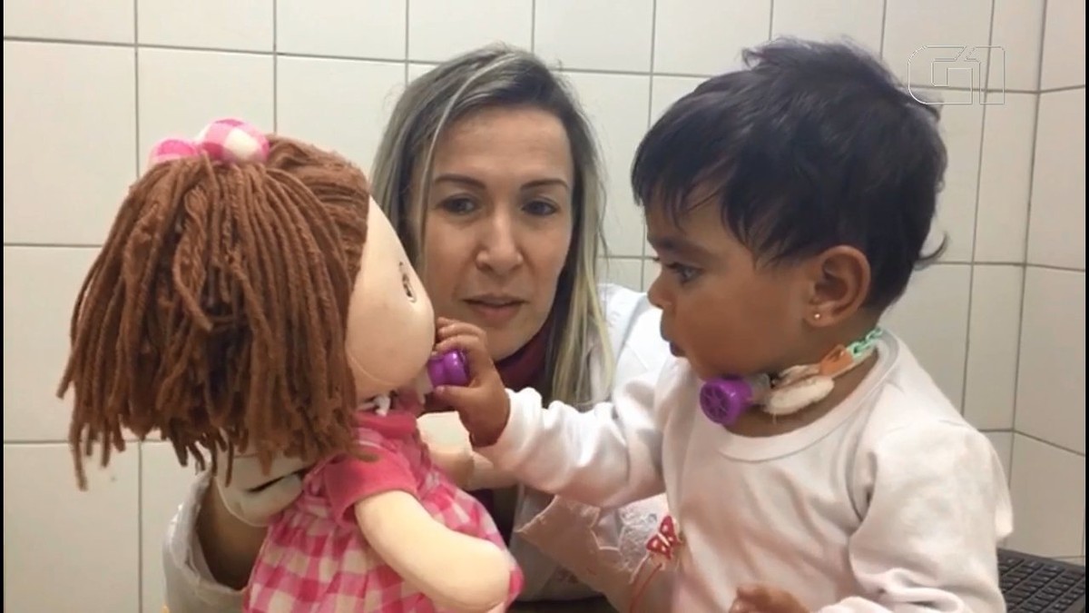 Bonecos adaptados auxiliam na recuperação de crianças com problemas ...