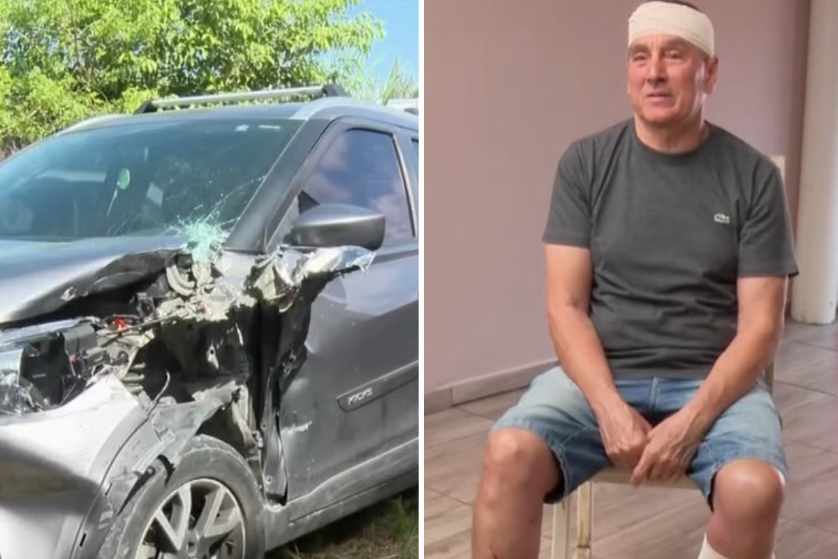 Idoso atropelado por motorista sem CNH em caminhonete furtada desabafa: 'Nasci de novo' | Santos ...