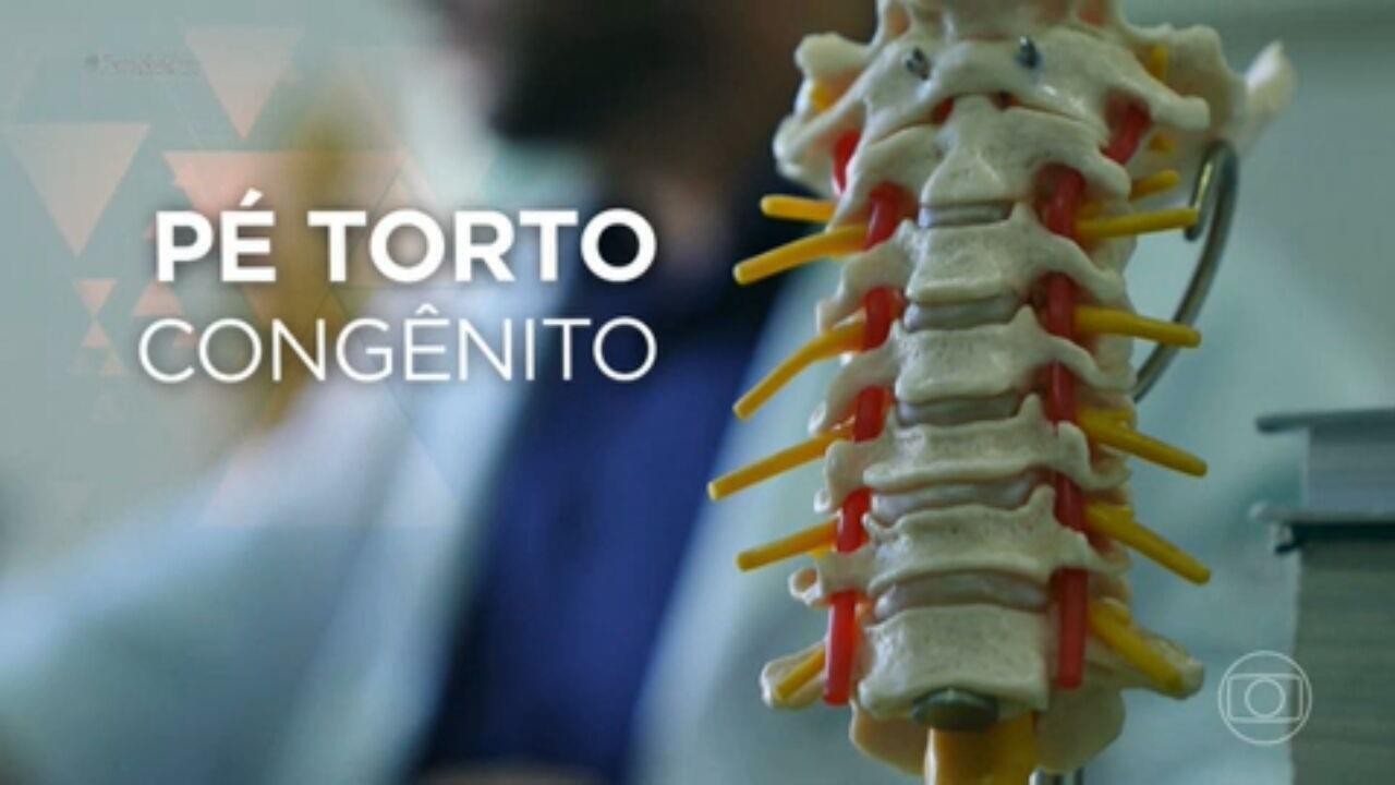 Pé torto congênito: entenda o que é e como é o tratamento | Fantástico | G1