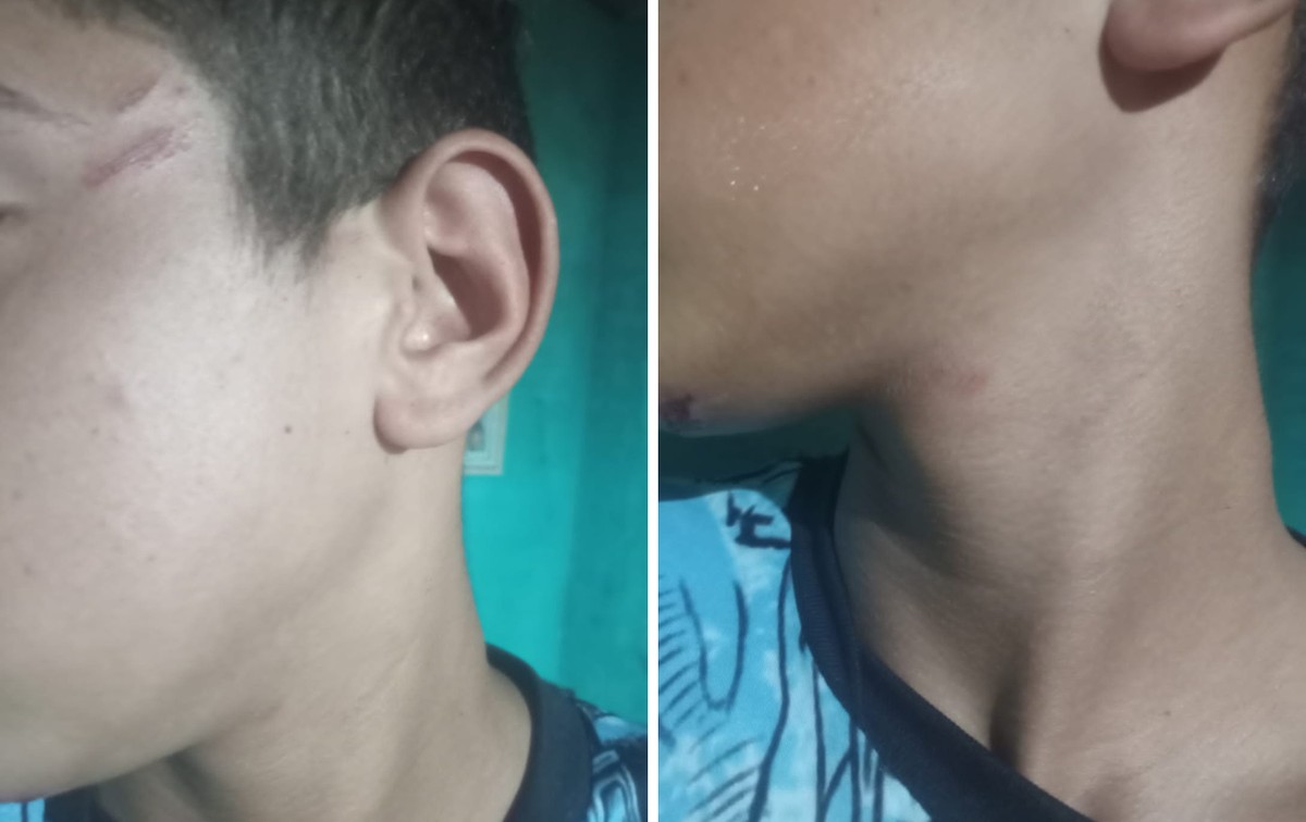 Pm Abre Inquérito Para Investigar Policiais Suspeitos De Agredirem