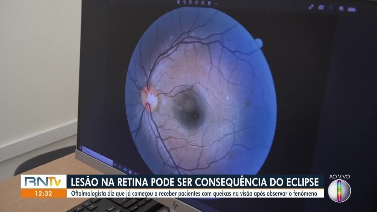 Oftalmologista atende paciente com lesão na retina após olhar para o ...