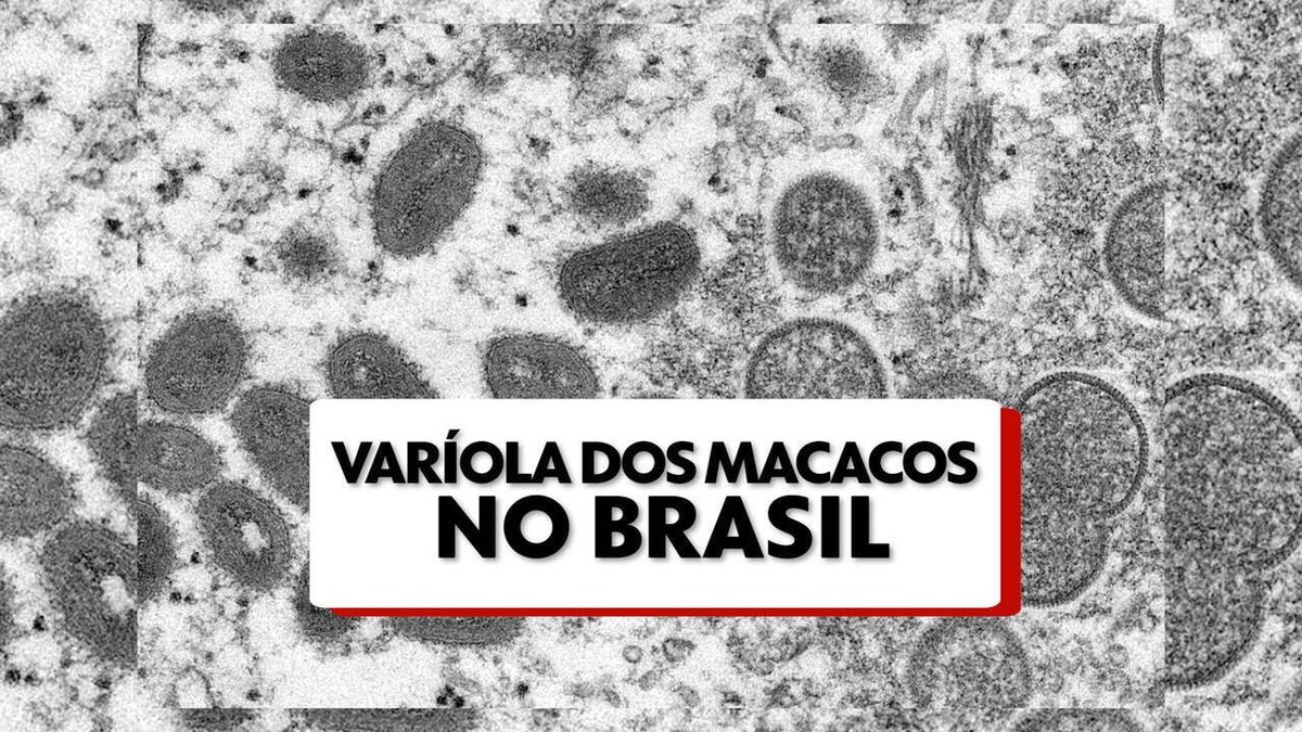 SC confirma segundo caso de varíola dos macacos | Santa Catarina | G1