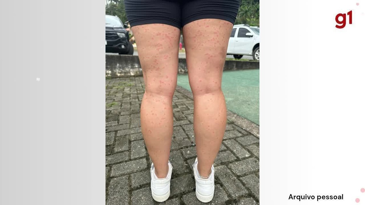 Conheça o maruim, inseto que levou cidade de SC a decretar emergência ...