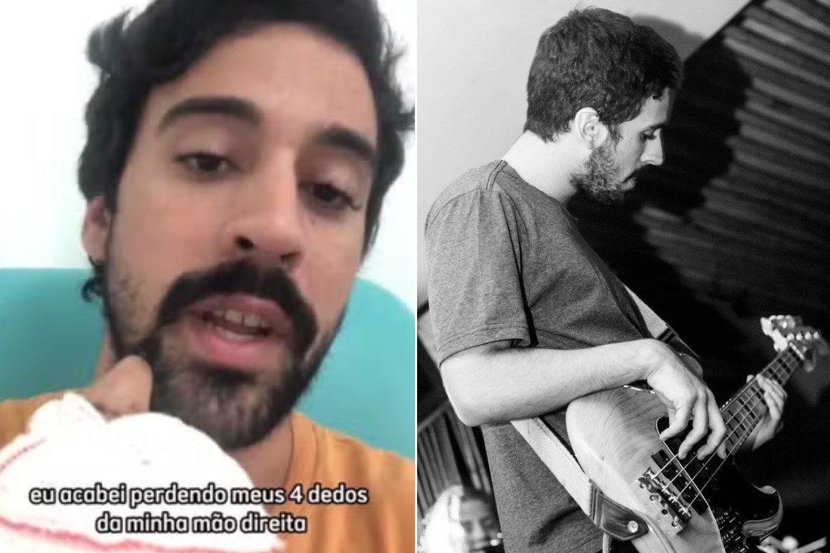 Baixista da banda Zimbra que perdeu quatro dedos diz estar acostumado a tocar com o dedão: 'o ...