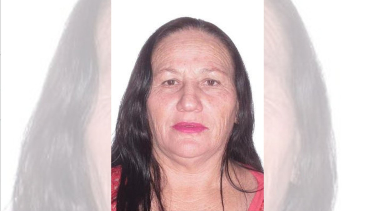 Mulher morre após ser atacada por pitbull em condomínio de chácaras no interior de SP | Bauru e ...