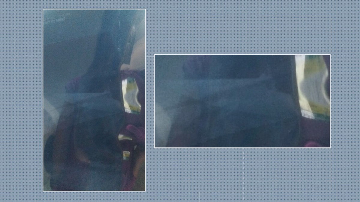 Paciente que passou mais de 40 h com faca cravada nas costas recebe ...